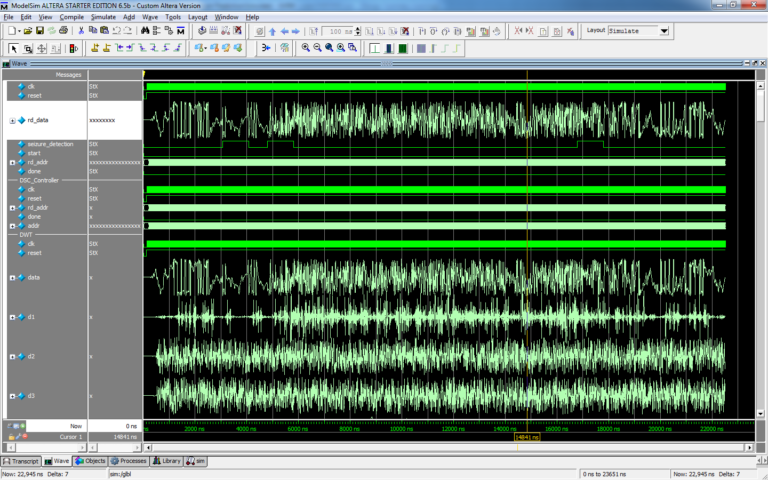 Vlsi Design Of Svm Based Seizure Detection System With On Chip